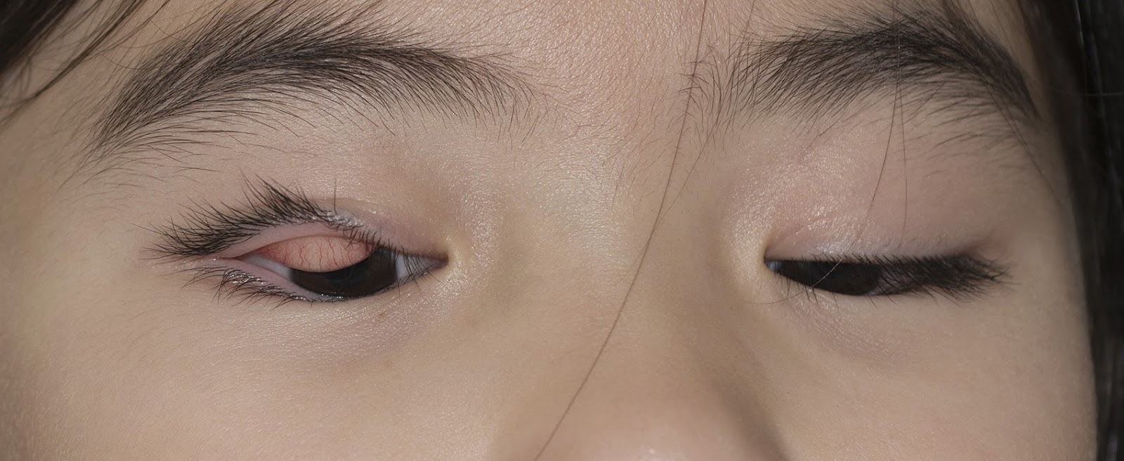 All things eye | Por Yong Ming: Stories of stubborn grit in the eye
